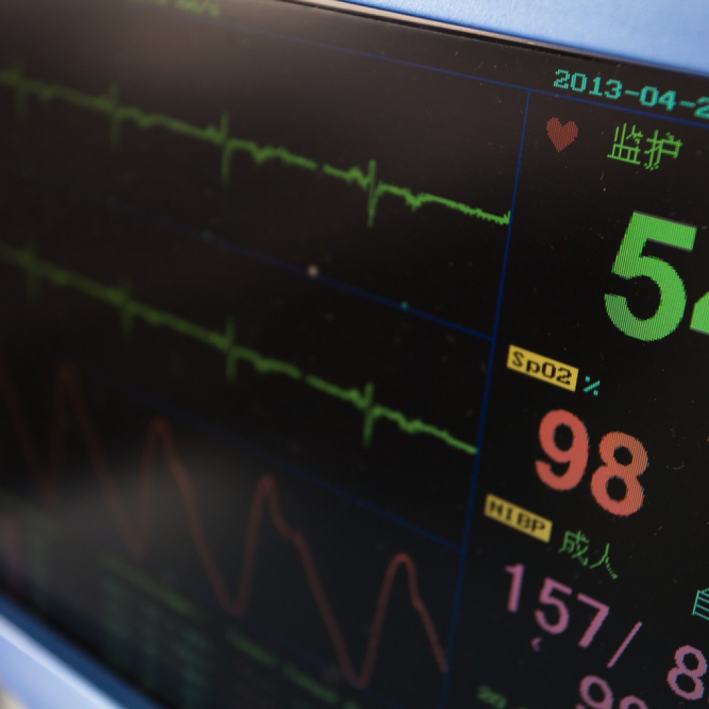 Studies Show iRhythm ZIO Service Reduces Cost Of Arrhythmia Detection ...